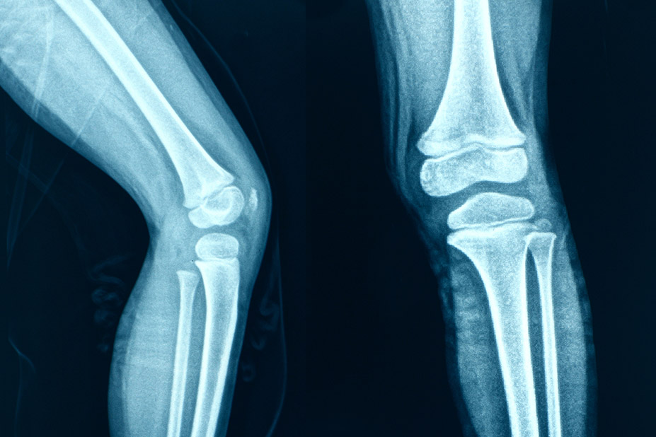 Knee – FLEX Institute
